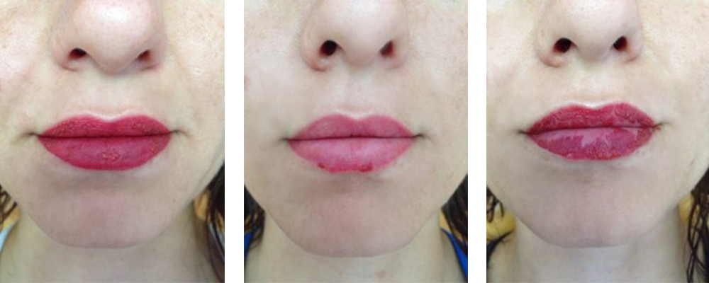 Lesson 05 Retention of the pigment - Vesta Academy of Permanent Makeup ...